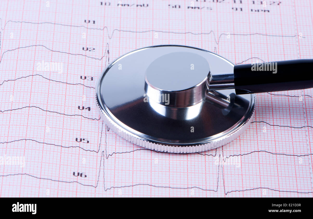 Ecg chart hi-res stock photography and images - Alamy