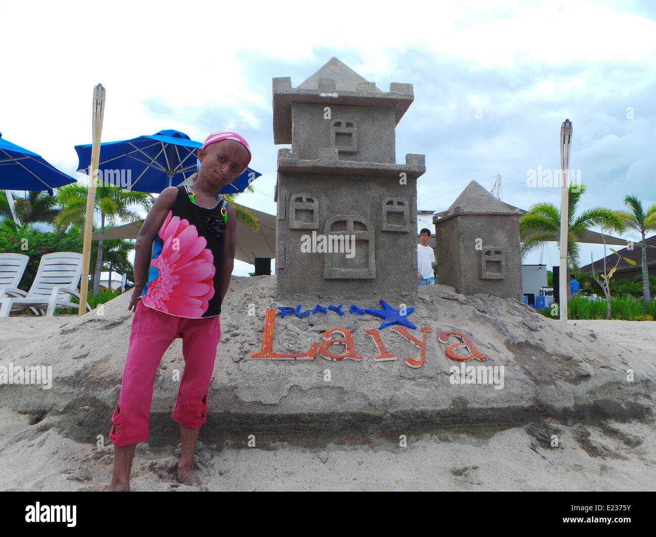 Laiya, Philippines. June 14, 2014. Rochelle Pondare, a kid with rare ...