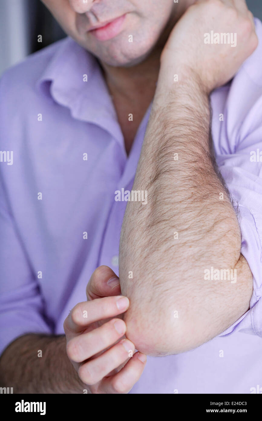 Itching in a man Stock Photo - Alamy