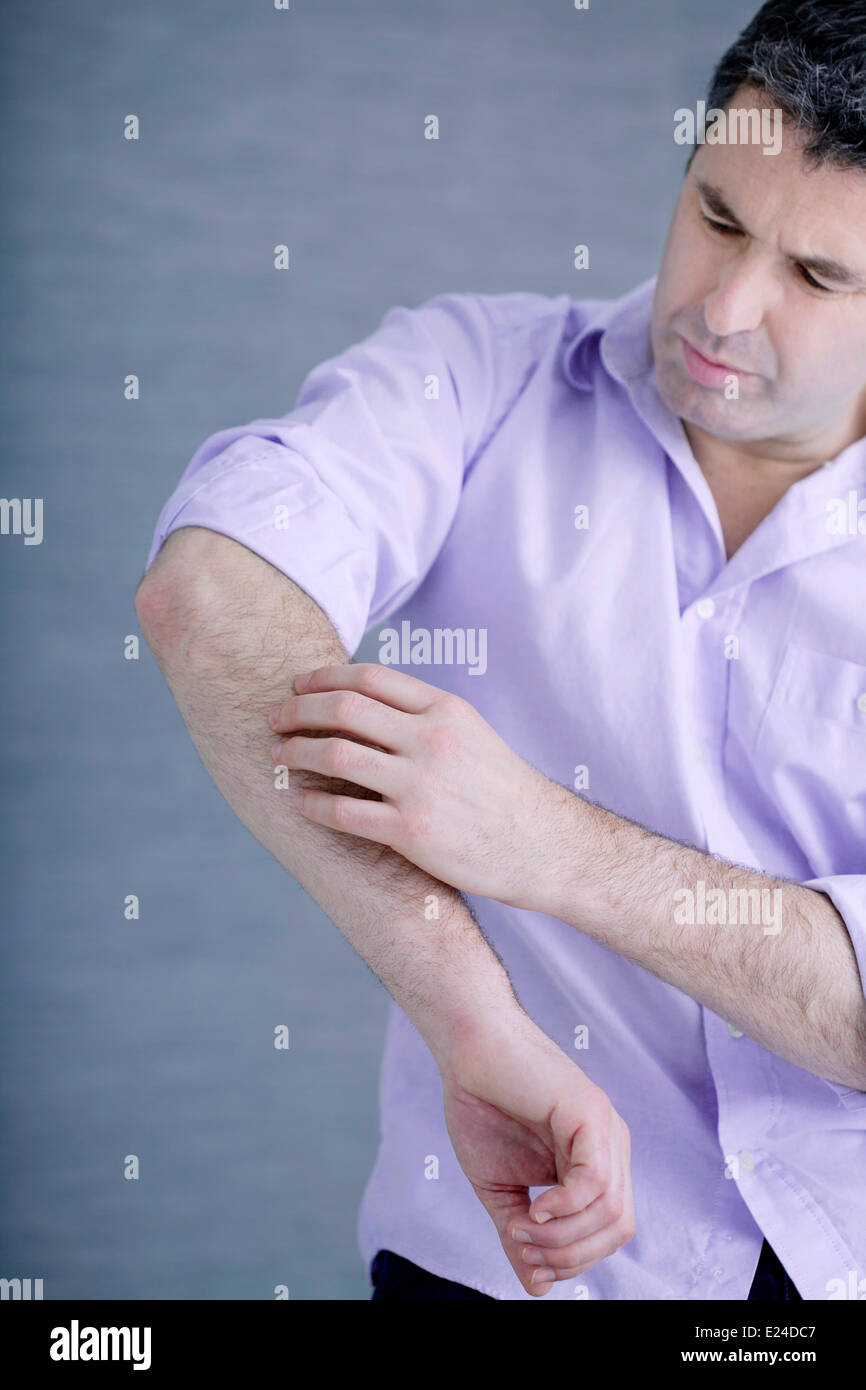Man scratching arm hi-res stock photography and images - Alamy