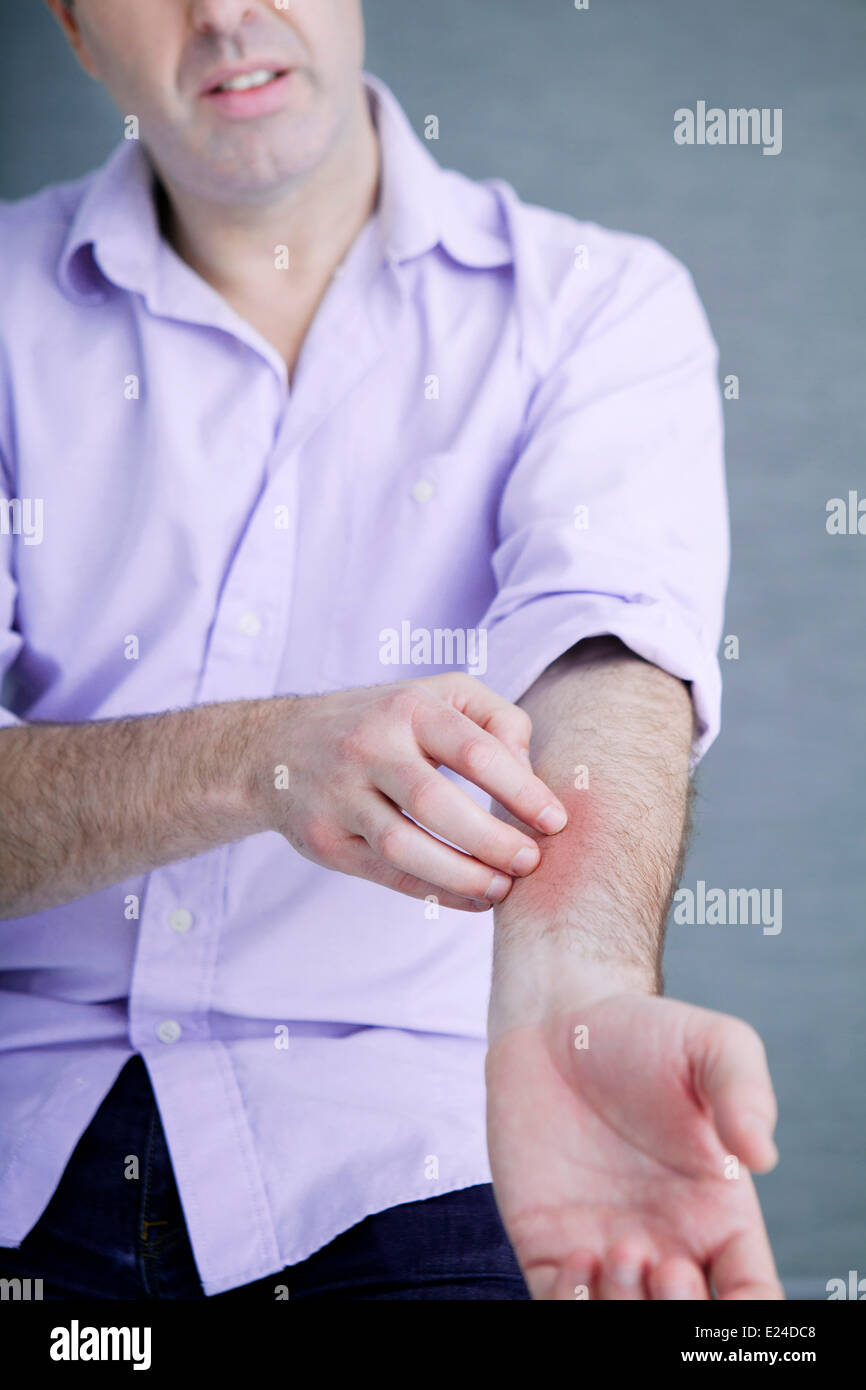 Itching in a man Stock Photo - Alamy
