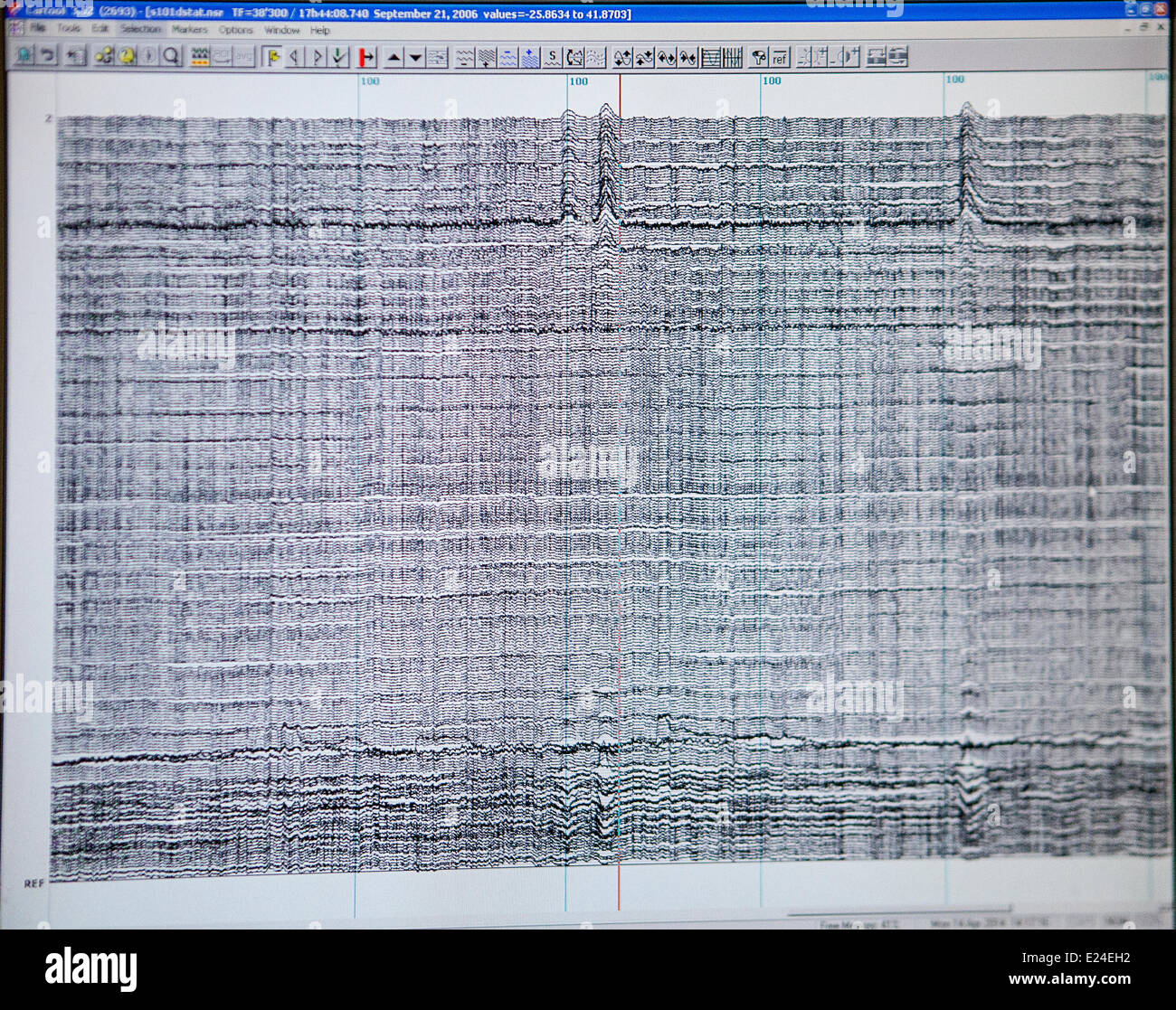 Eeg brain screen hi-res stock photography and images - Alamy