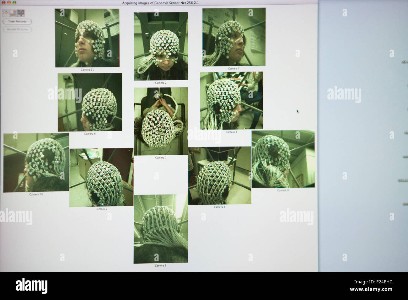 Study of brain Stock Photo - Alamy