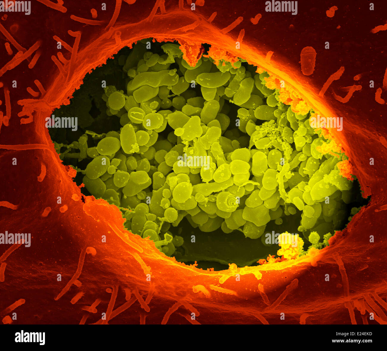 Coxiella burnetii, the bacteria that causes q fever Stock Photo - Alamy