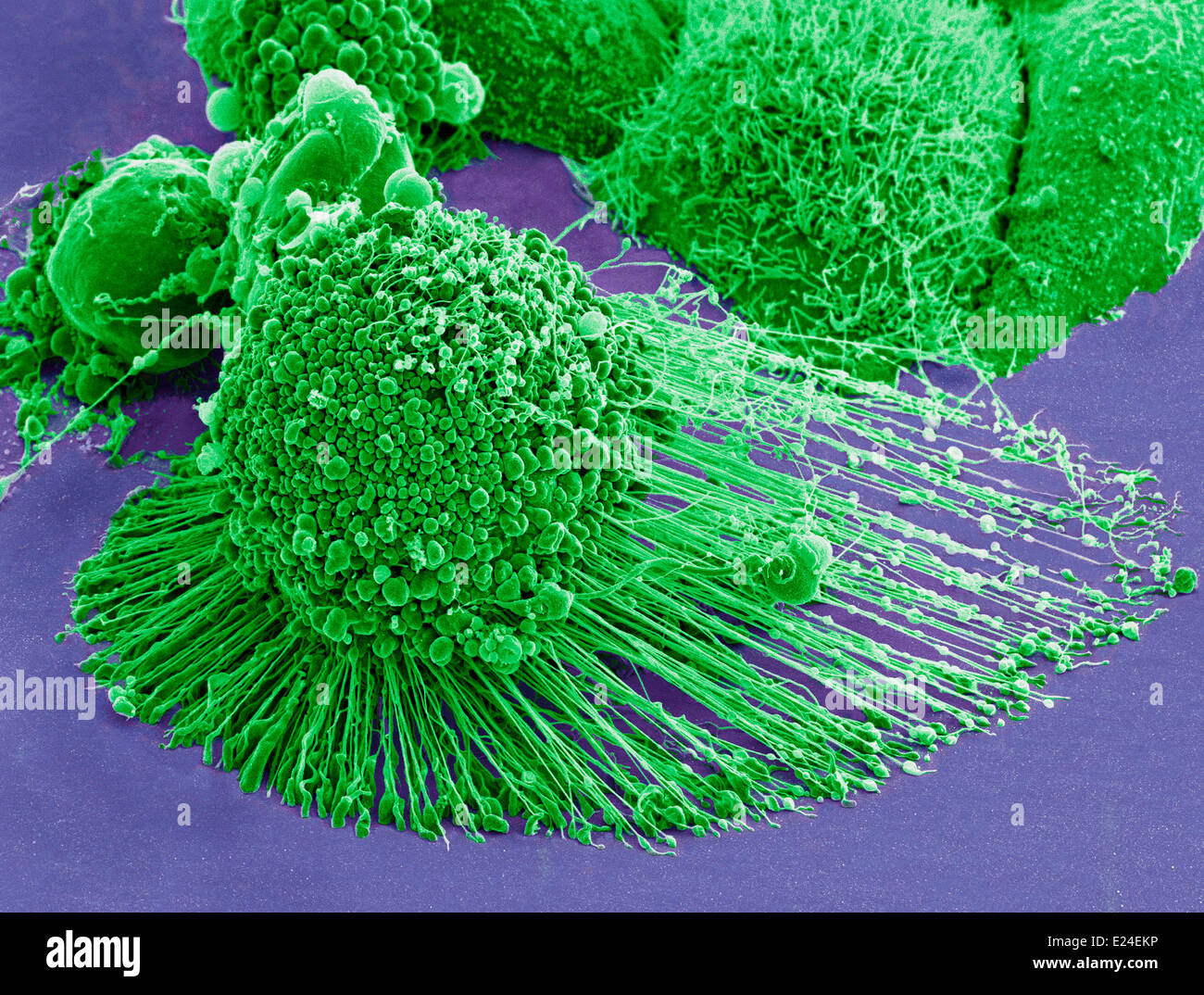 Hela cell hi-res stock photography and images - Alamy