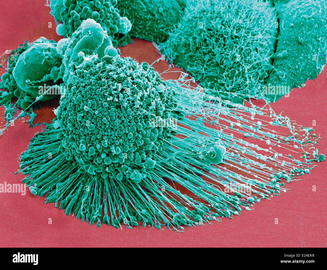 Hela cells hi-res stock photography and images - Alamy