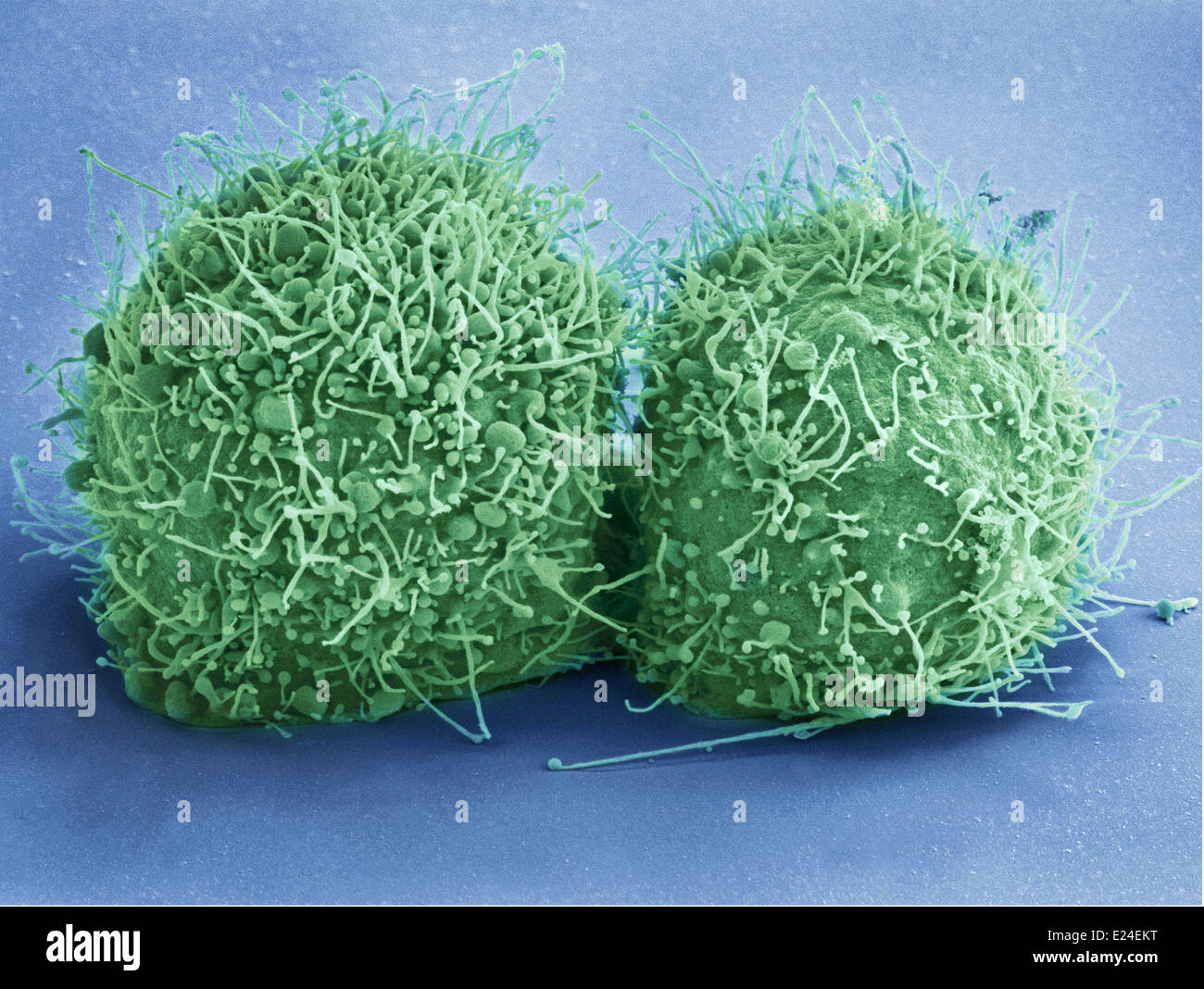 Hela cell hi-res stock photography and images - Alamy