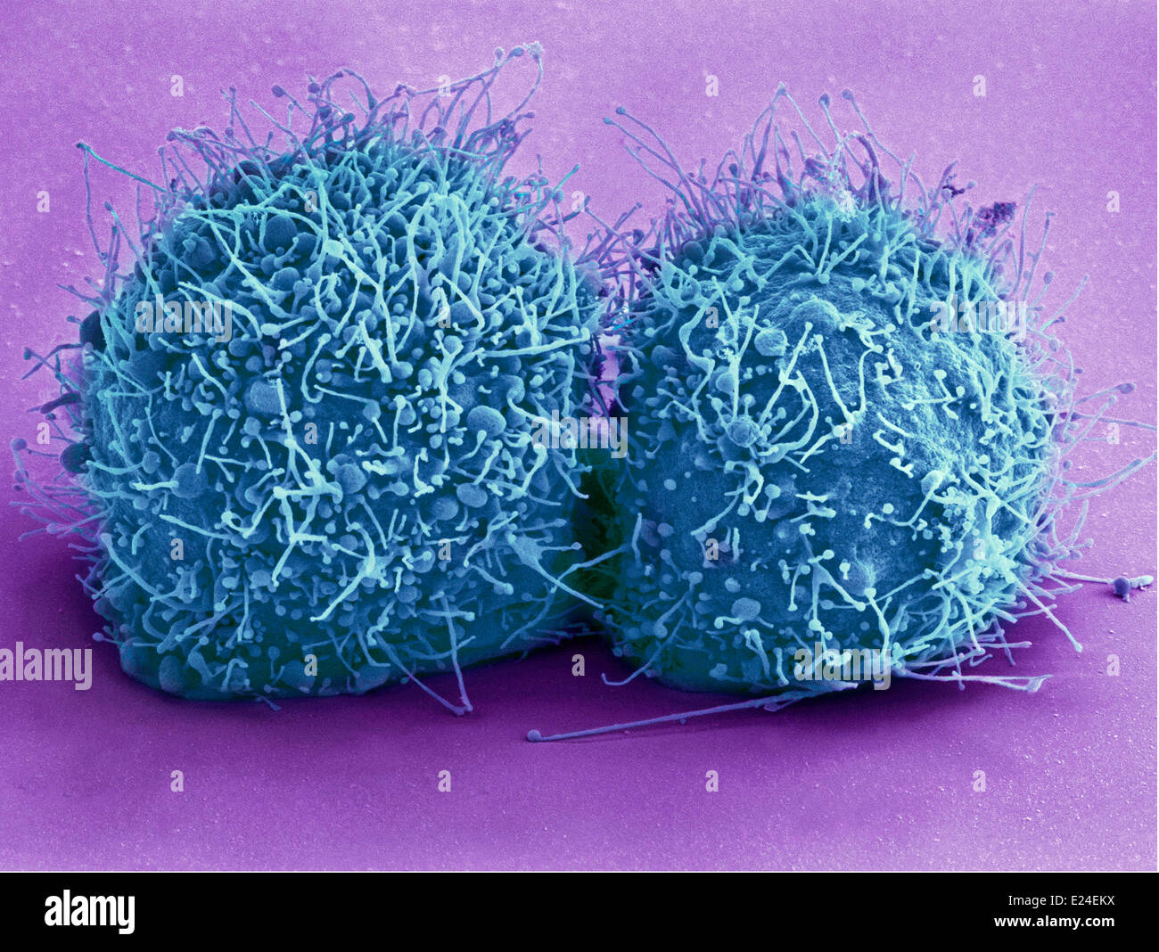 Hela cell hi-res stock photography and images - Alamy