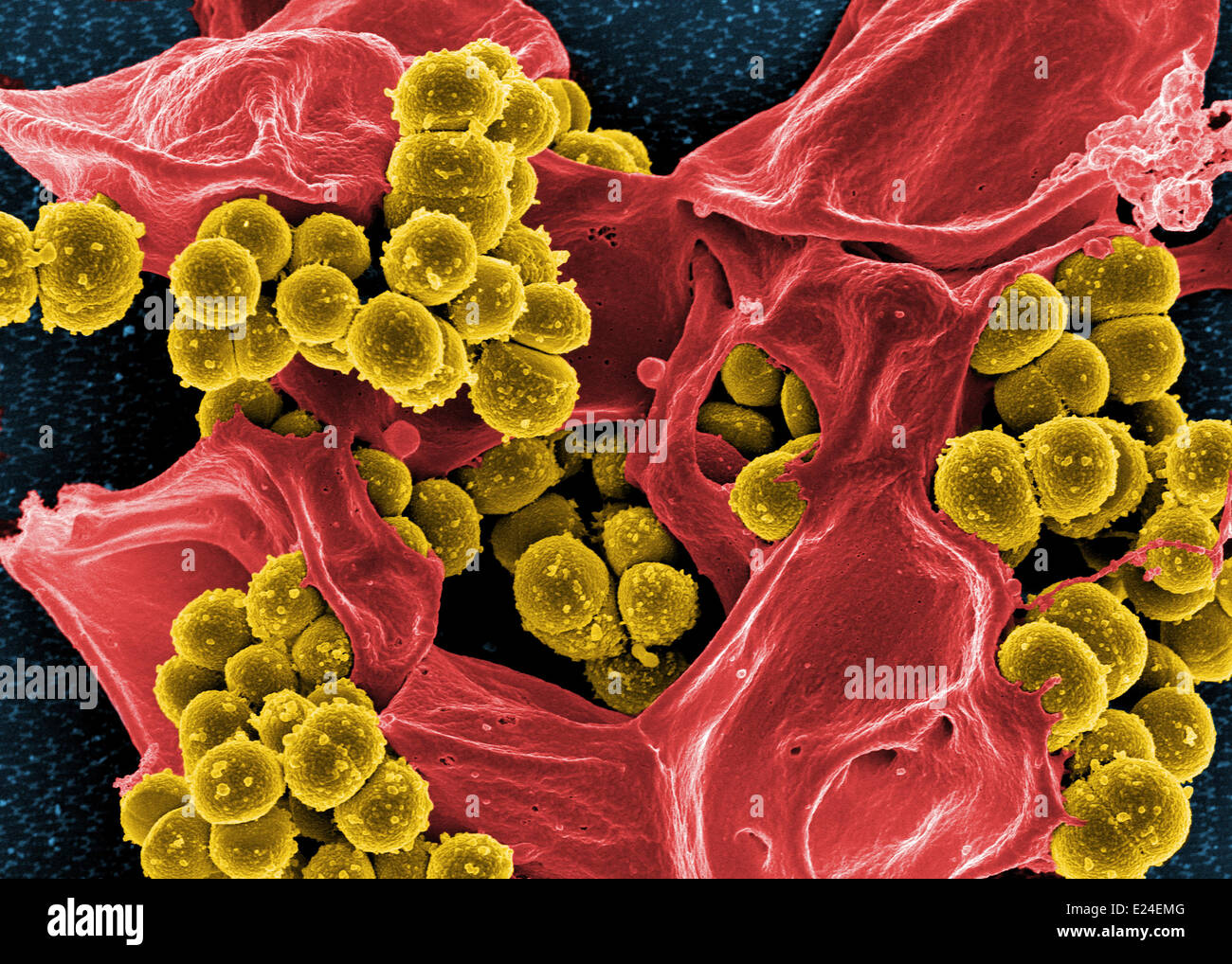 Dead cells hi-res stock photography and images - Alamy