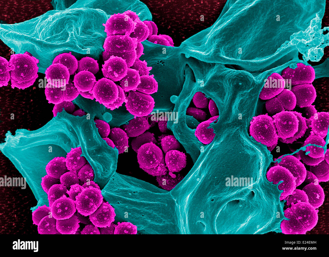 Mrsa and a dead human neutrophil Stock Photo - Alamy