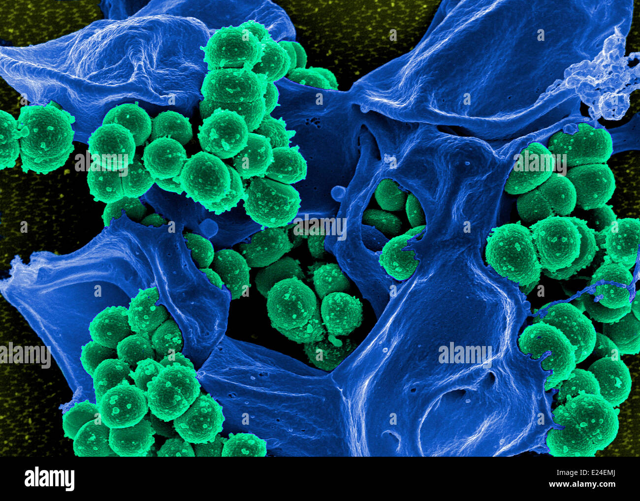 Mrsa and a dead human neutrophil Stock Photo - Alamy