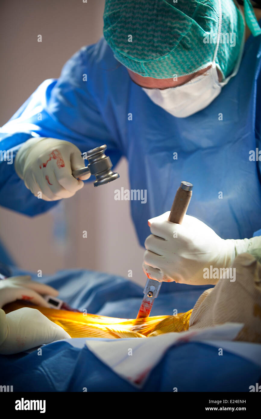 External fixation tibia hi-res stock photography and images - Alamy