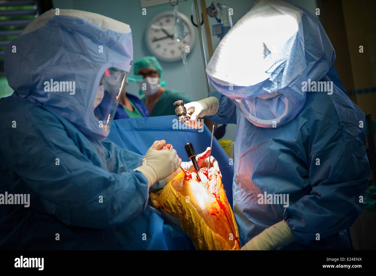 Lower limb intervention hi-res stock photography and images - Alamy