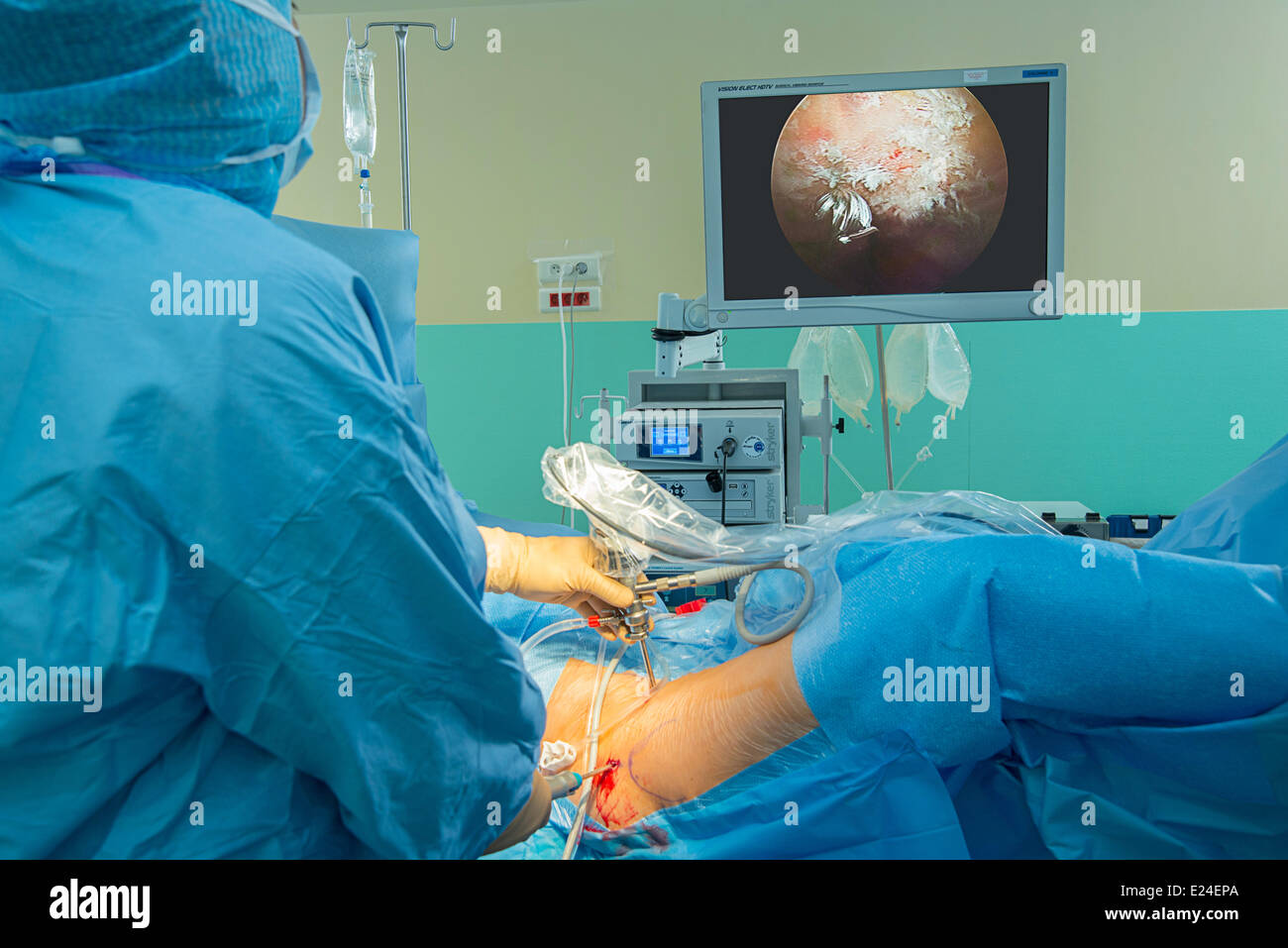 Human Hip Operation High Resolution Stock Photography and Images - Alamy