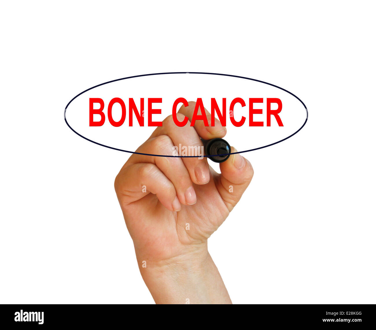 writing word BONE CANCER with marker on white background made in 2d ...