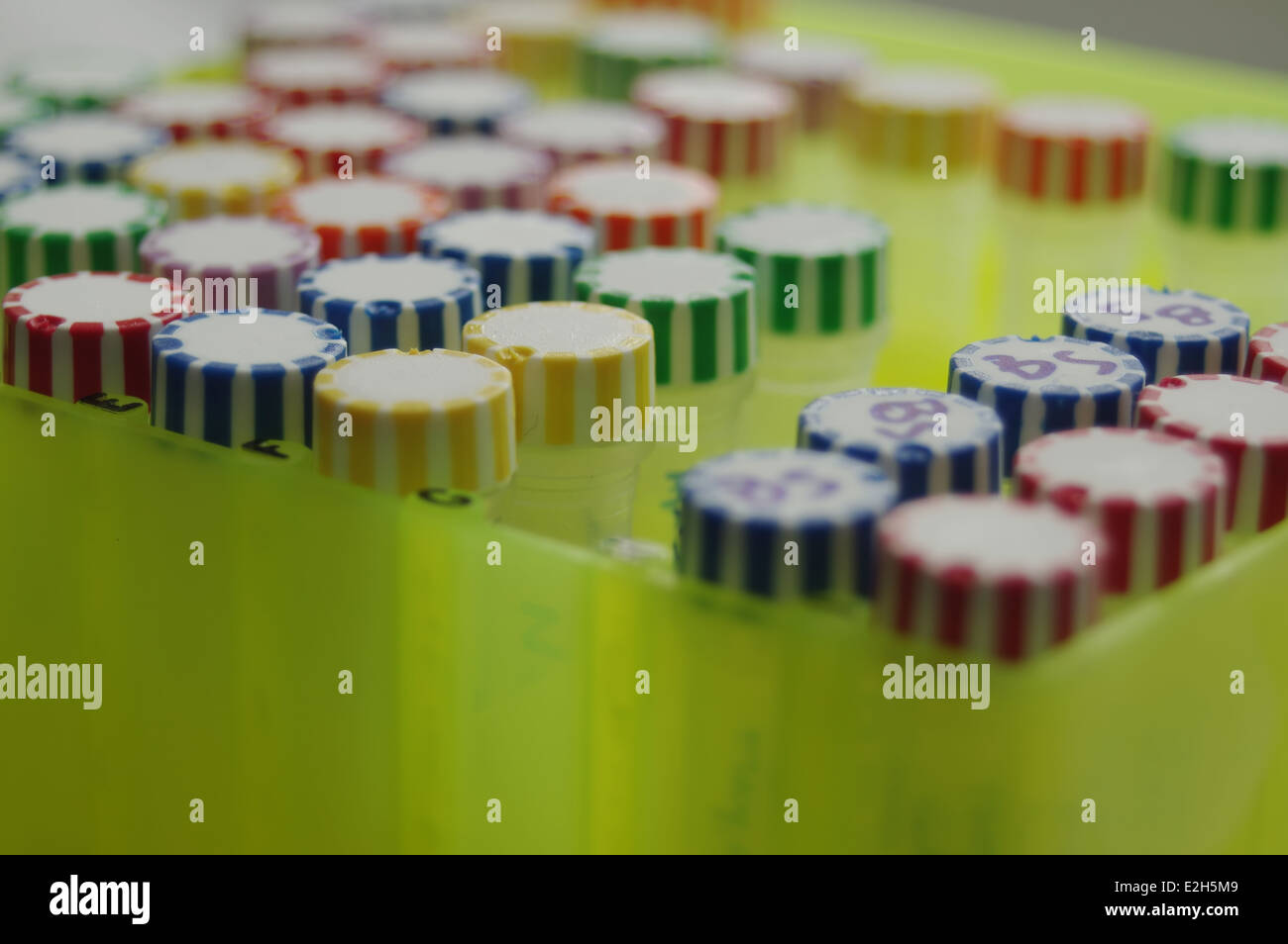 2 mL. plastic vials with patient samples, positioned on a racks Stock ...