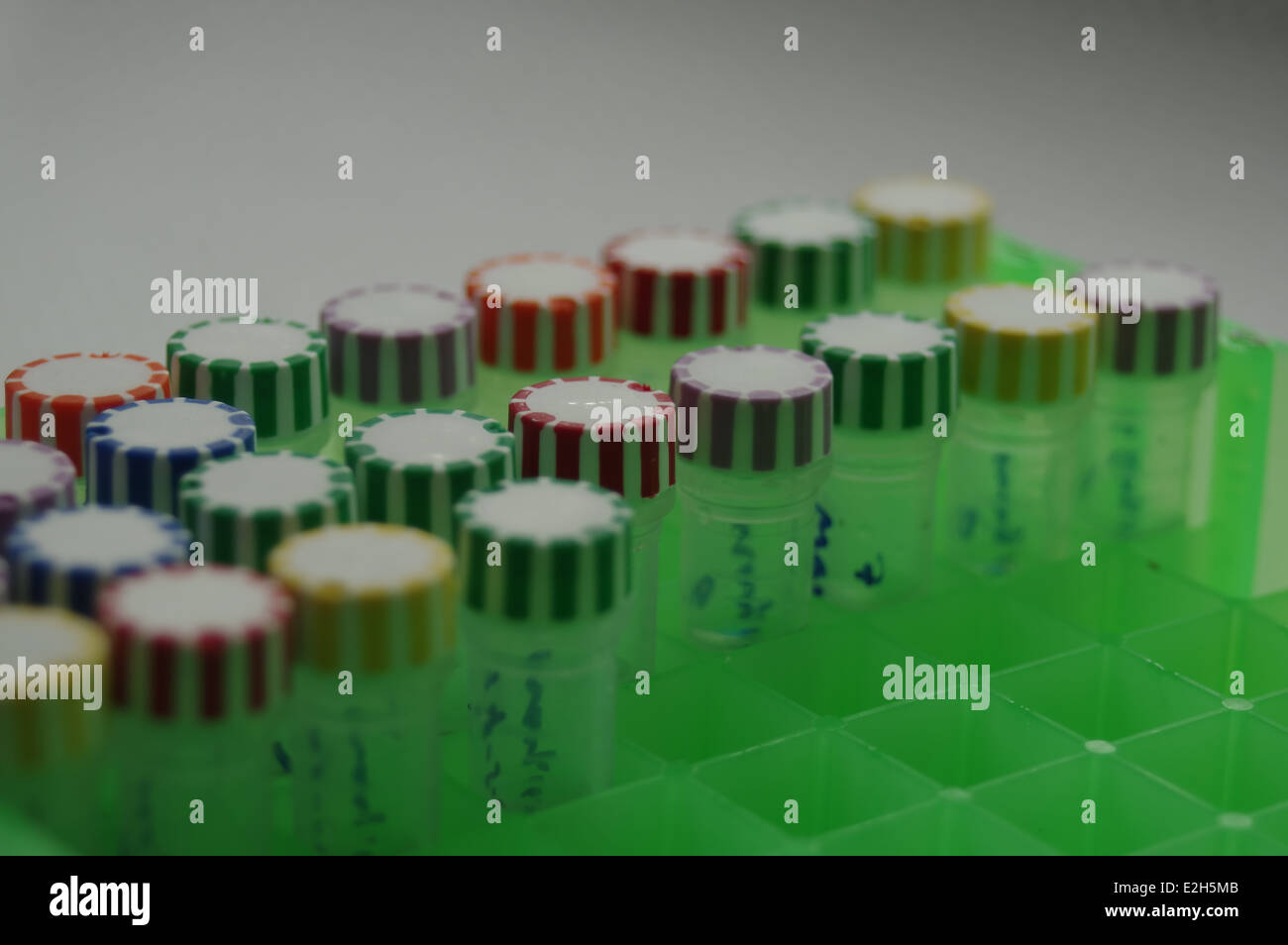 2 mL. plastic vials with patient samples, positioned on a racks Stock ...