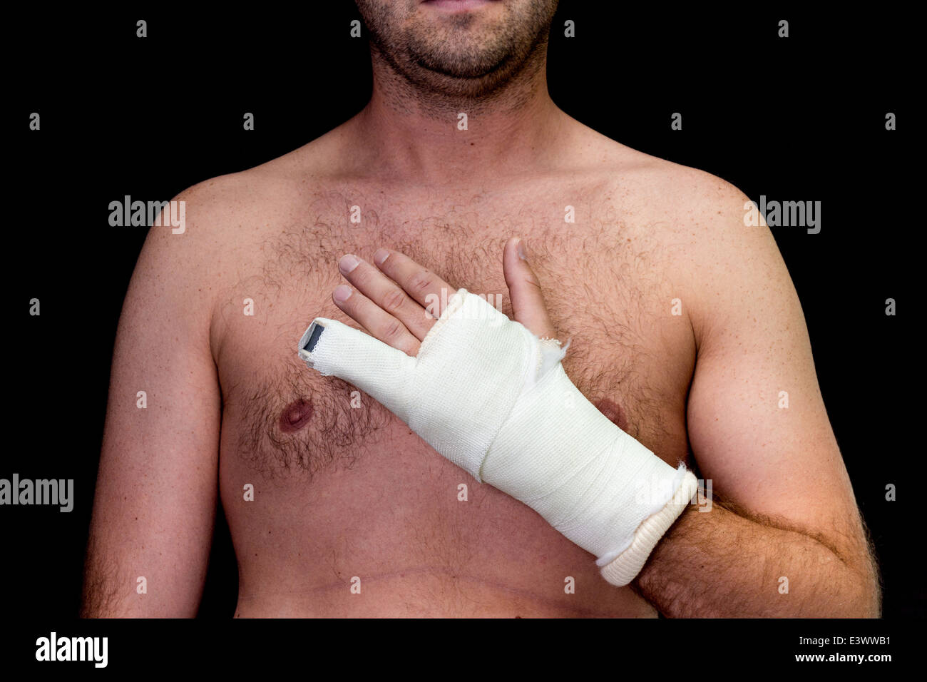 Man with little finger/arm/wrist in cast on a black background, studio ...