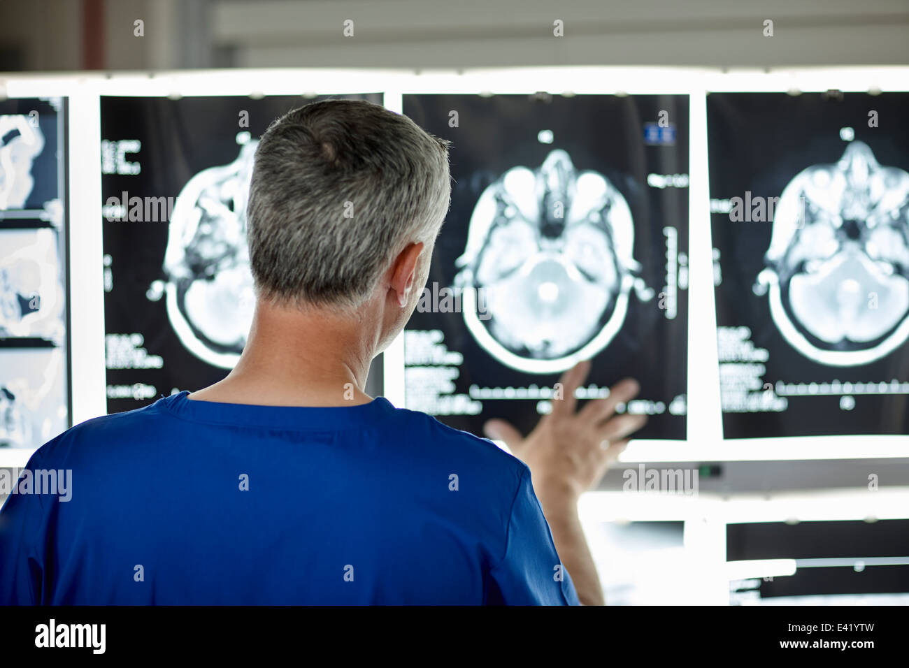 Hospital brain scans hi-res stock photography and images - Alamy