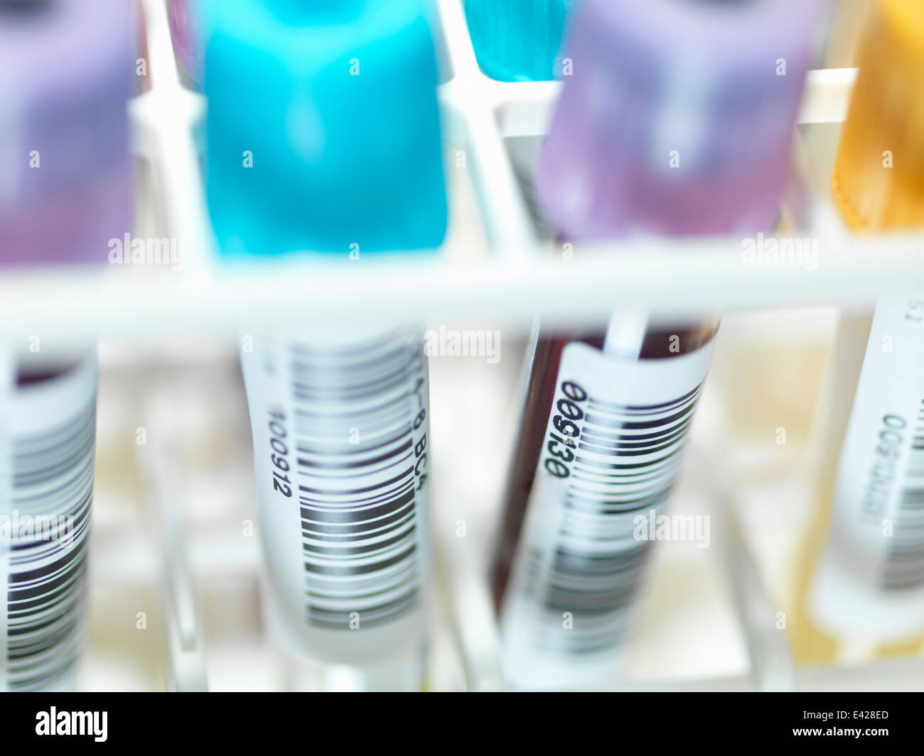 A row of human blood and chemistry samples awaiting testing in the lab ...