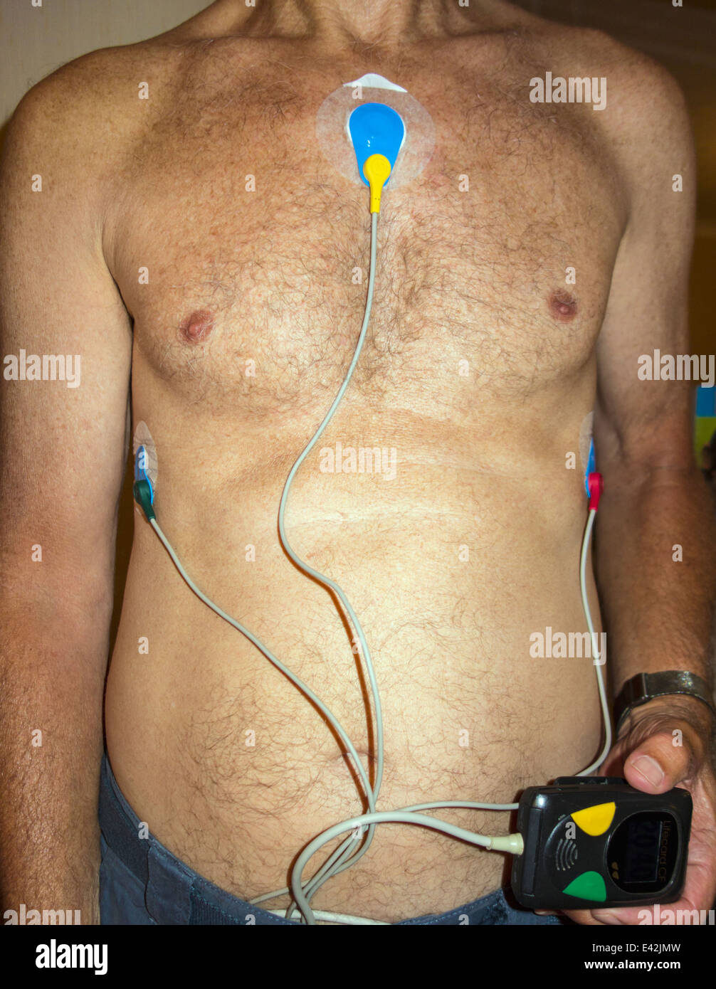 Heart Attack Ecg Stock Photos & Heart Attack Ecg Stock Images - Alamy