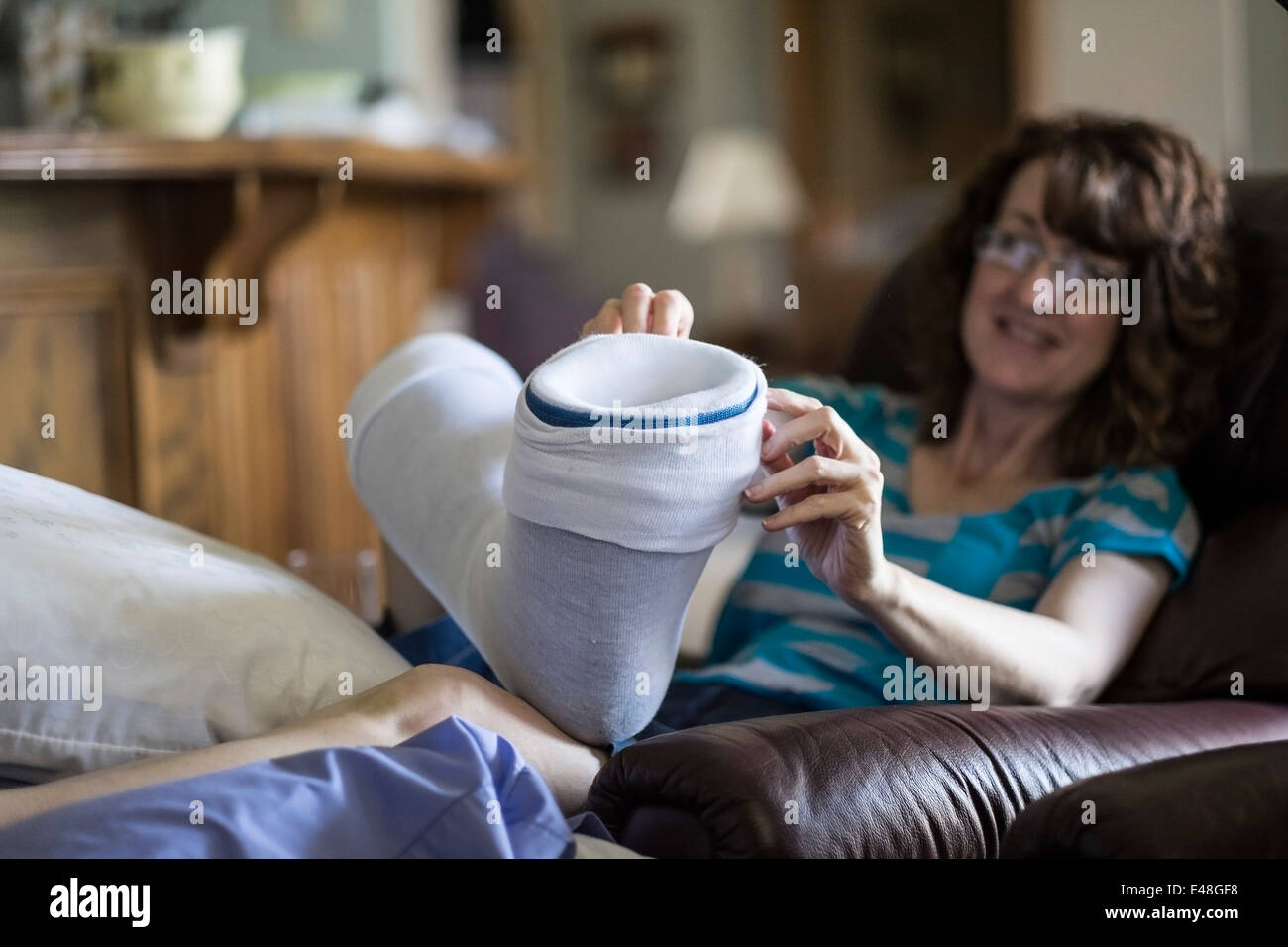 Foot cast hi-res stock photography and images - Alamy