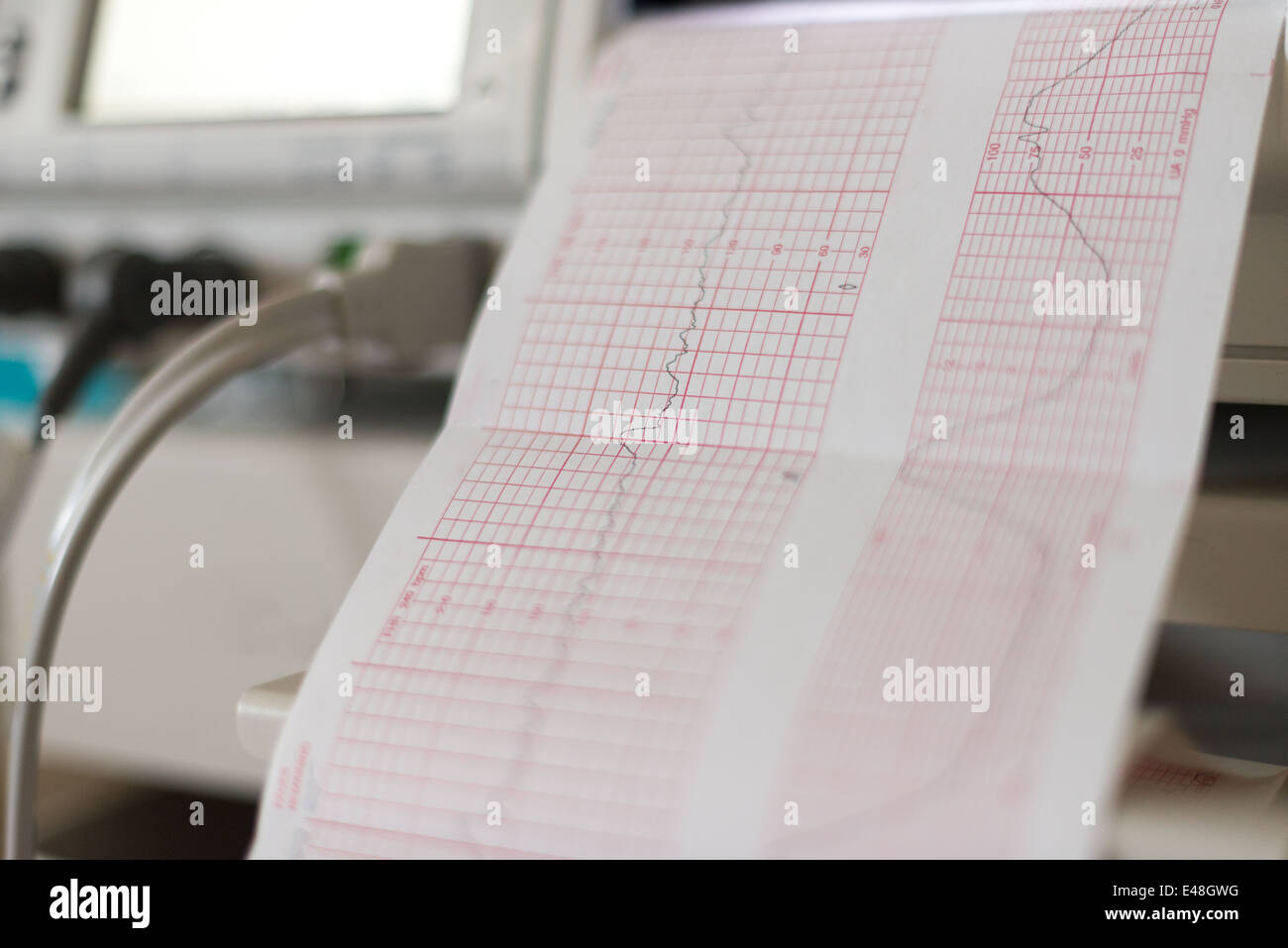 Fetal heart rate monitor hi-res stock photography and images - Alamy