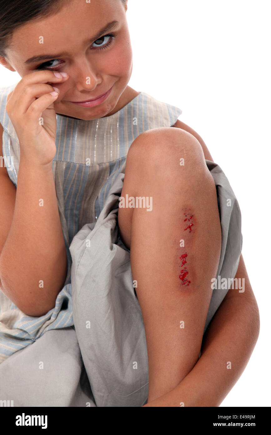 Teens Of Cuts On Legs