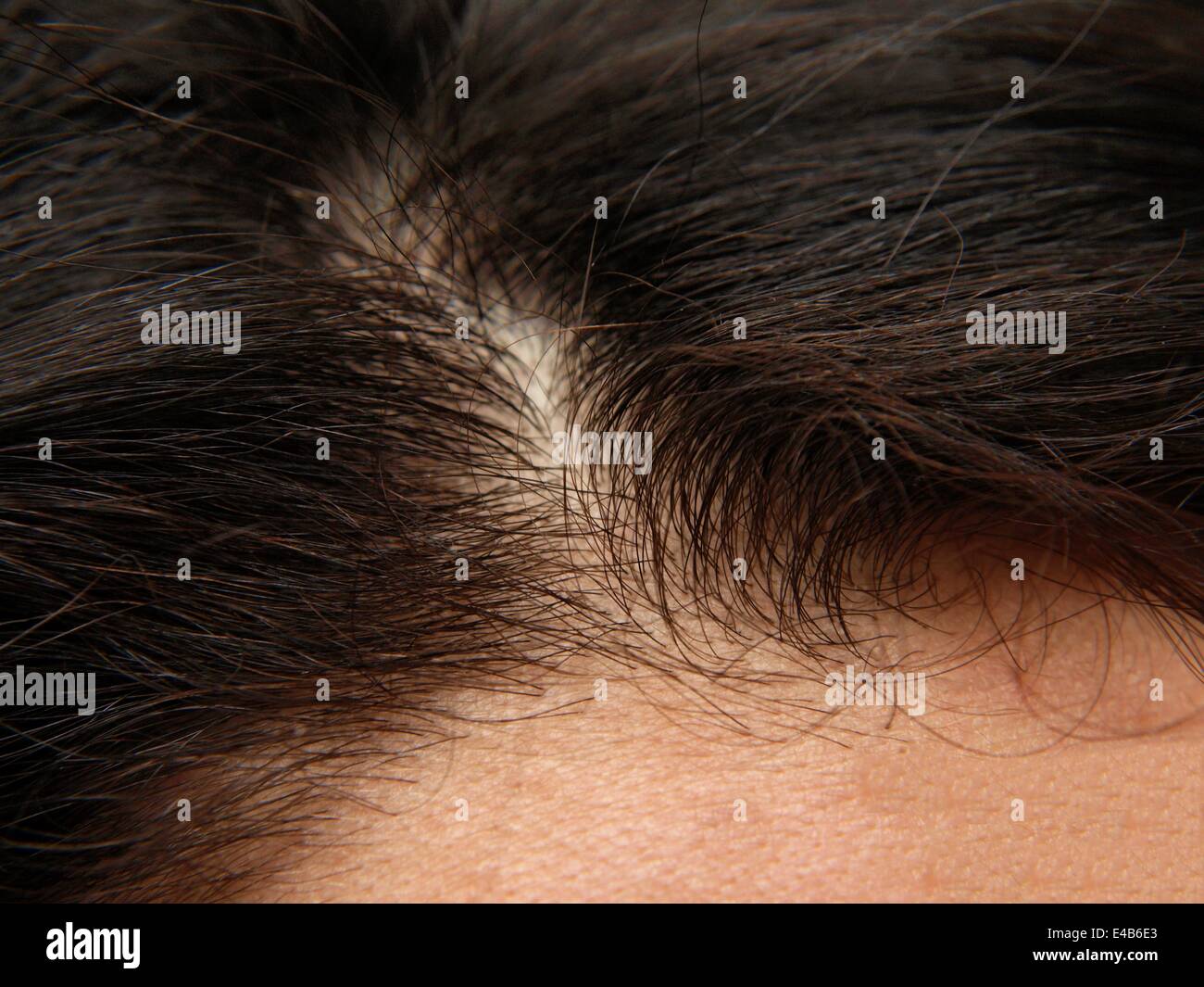 Top of head scalp hi-res stock photography and images - Alamy
