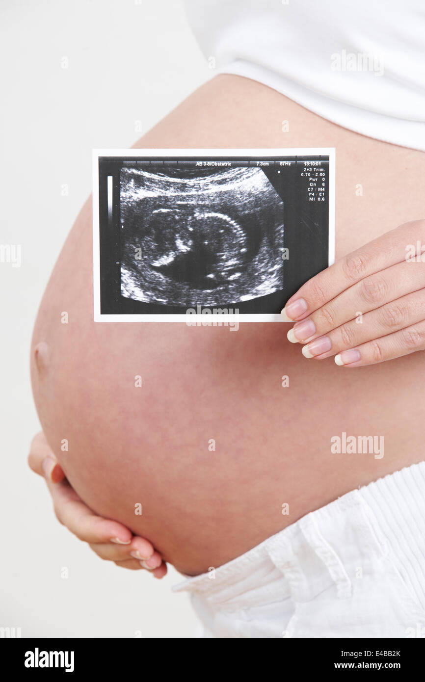 Ultrasound scan female pregnant hi-res stock photography and images - Alamy