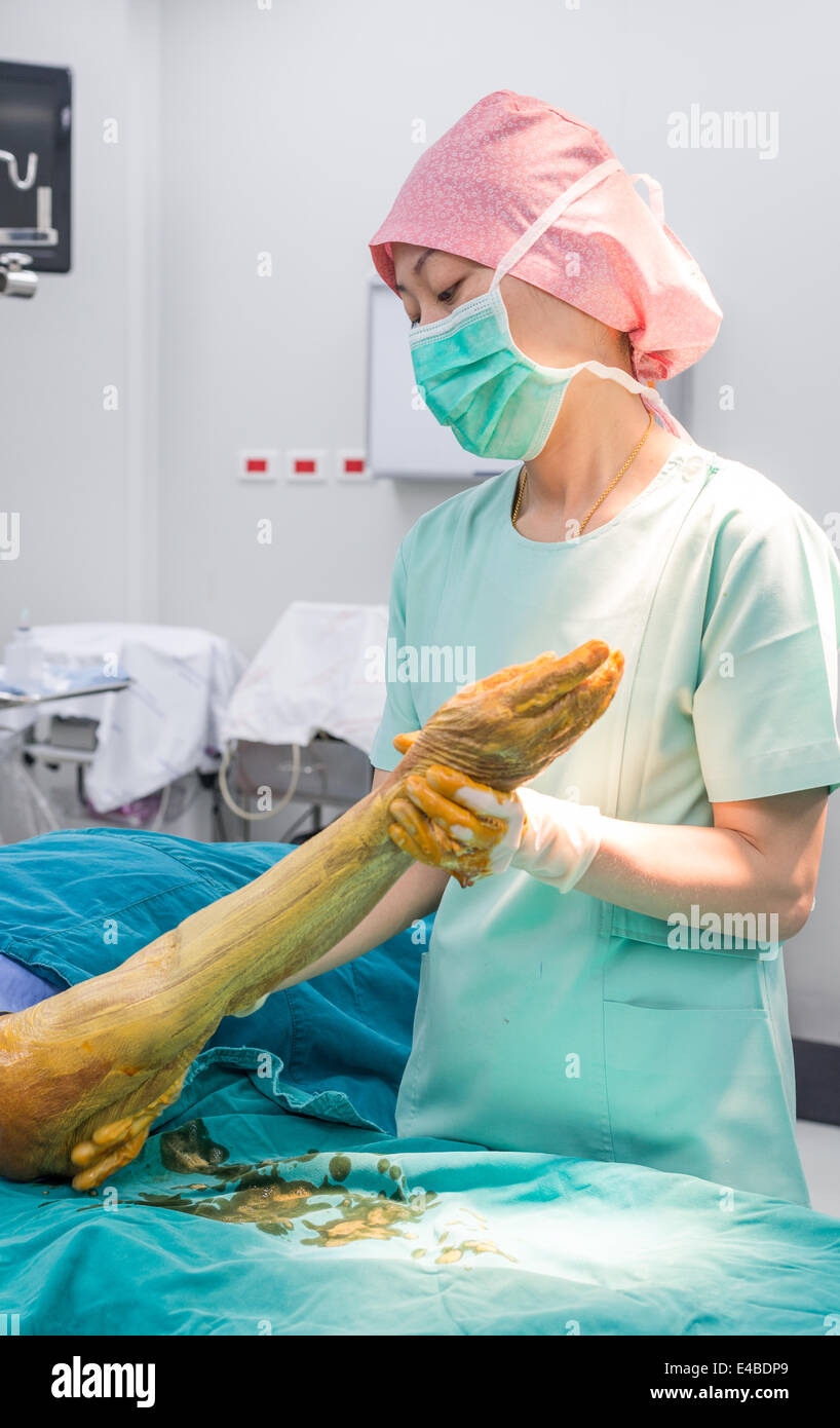 Scrub nurse use cleaning solution paint all forearm and arm prepare for ...