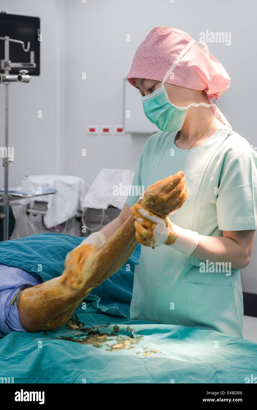 Scrub nurse use cleaning solution paint all forearm and arm prepare for ...