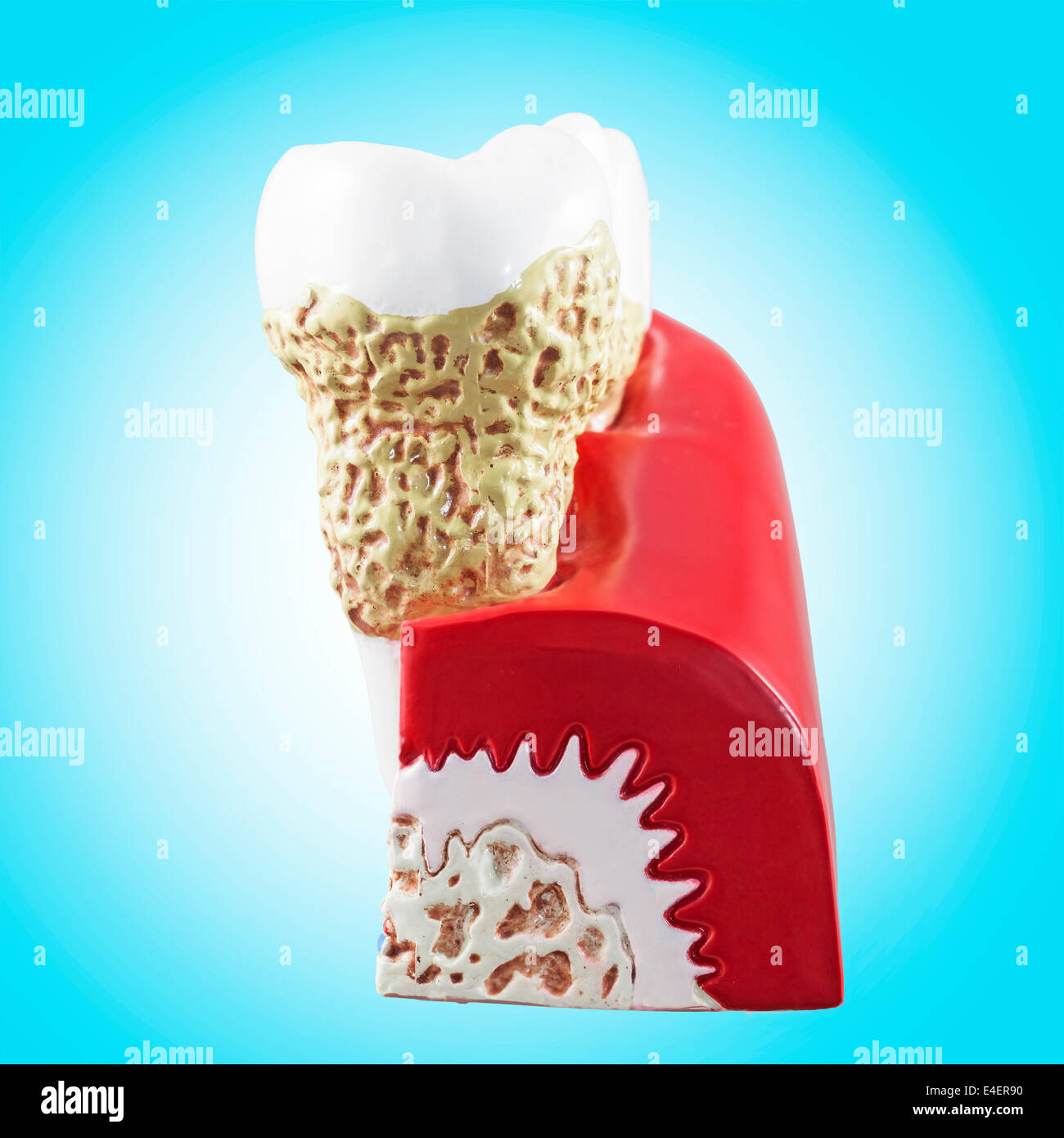 Tooth, dental section model Stock Photo - Alamy