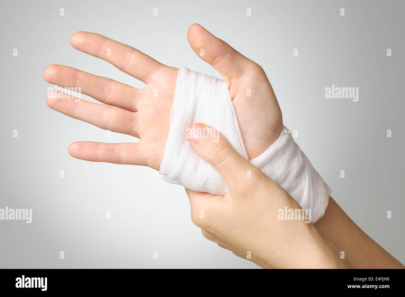Joint damage hands hi-res stock photography and images - Alamy