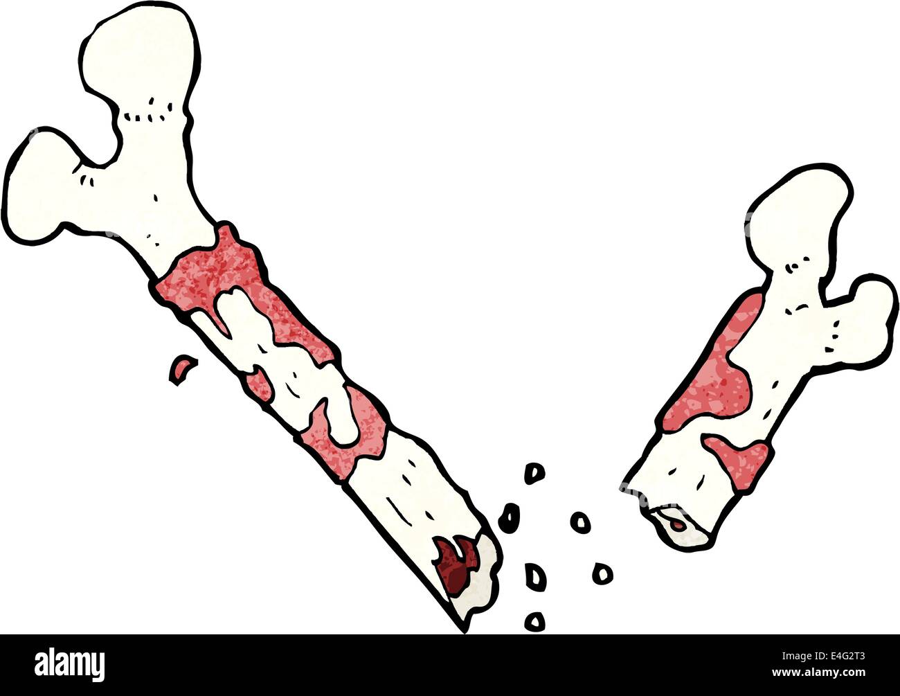 gross broken bone cartoon Stock Vector Image & Art - Alamy