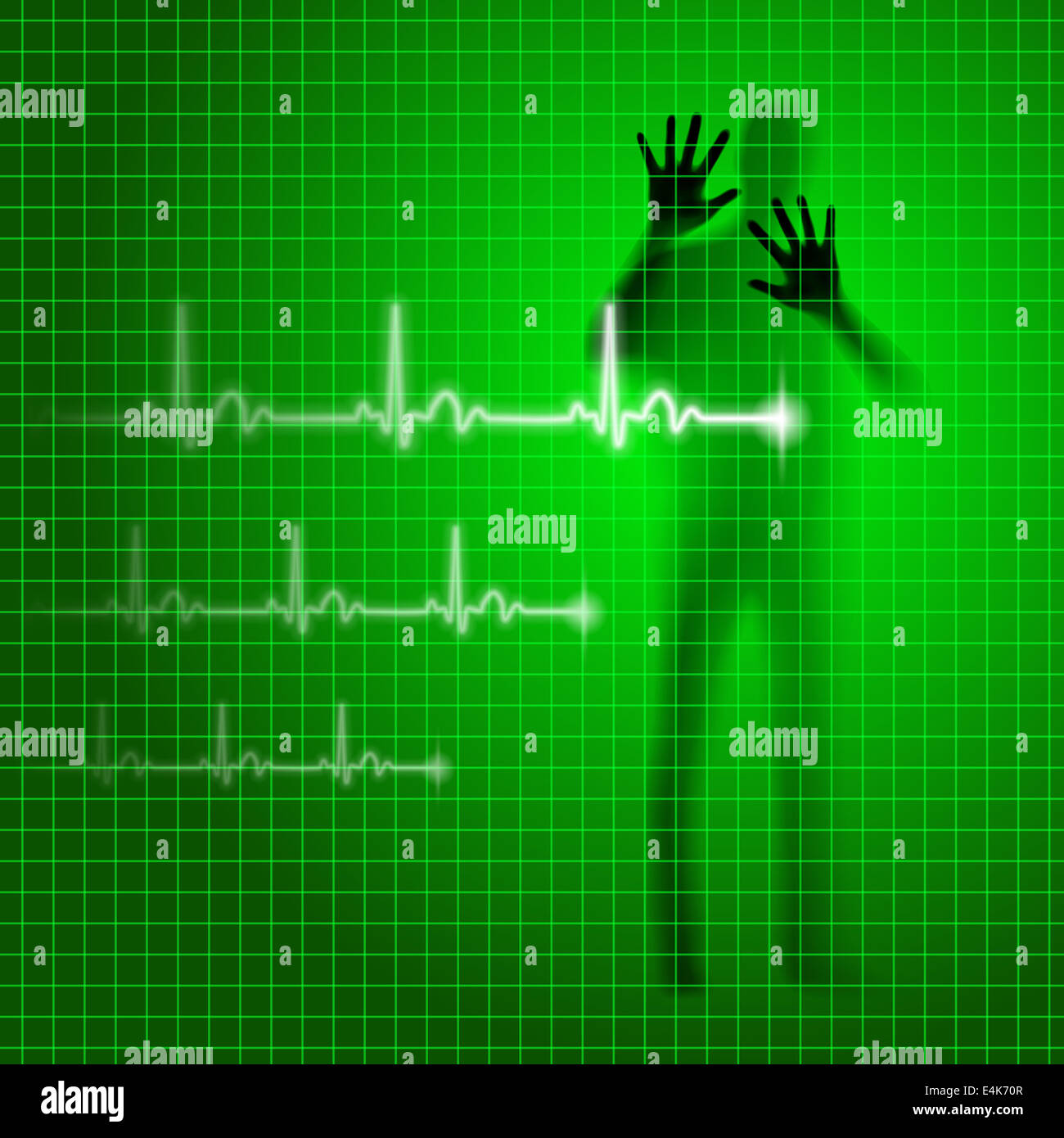 Shining green medical background with human silhouette and cardiogram ...