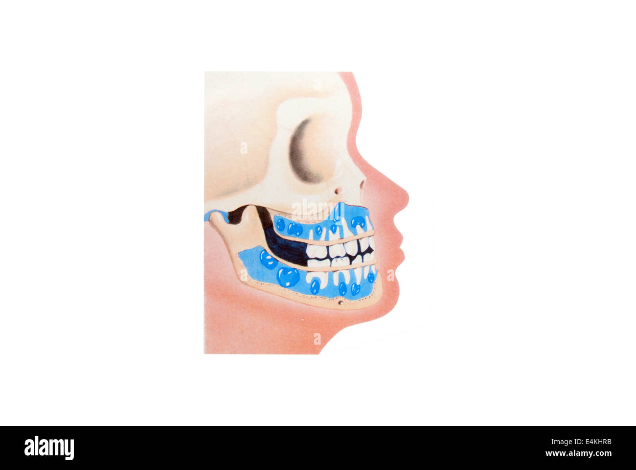 Roots of teeth hi-res stock photography and images - Alamy