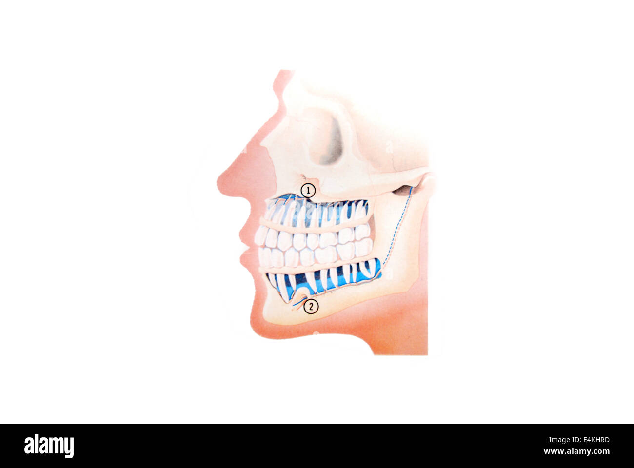 Child skull adult teeth hi-res stock photography and images - Alamy
