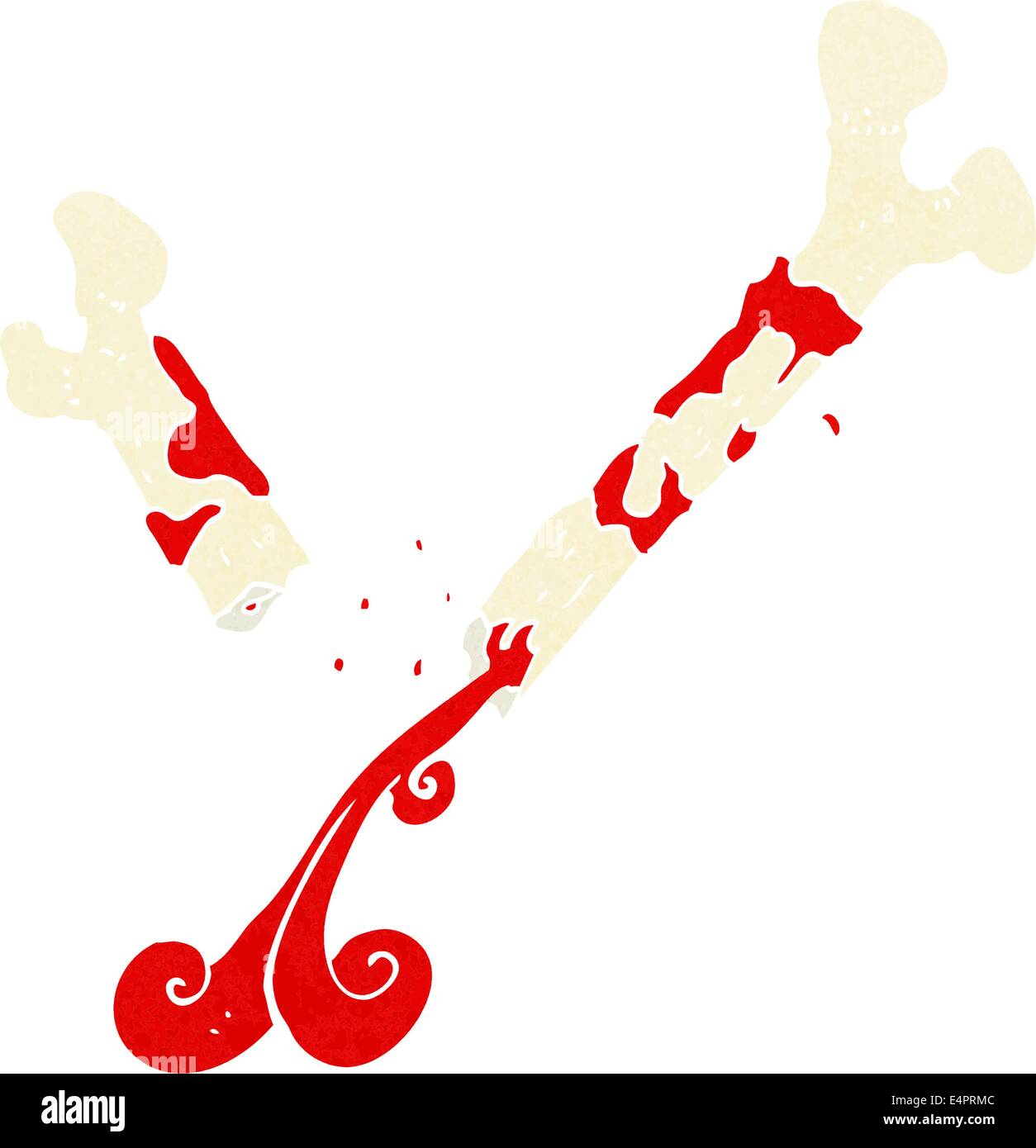 gross broken bone cartoon Stock Vector Image & Art - Alamy