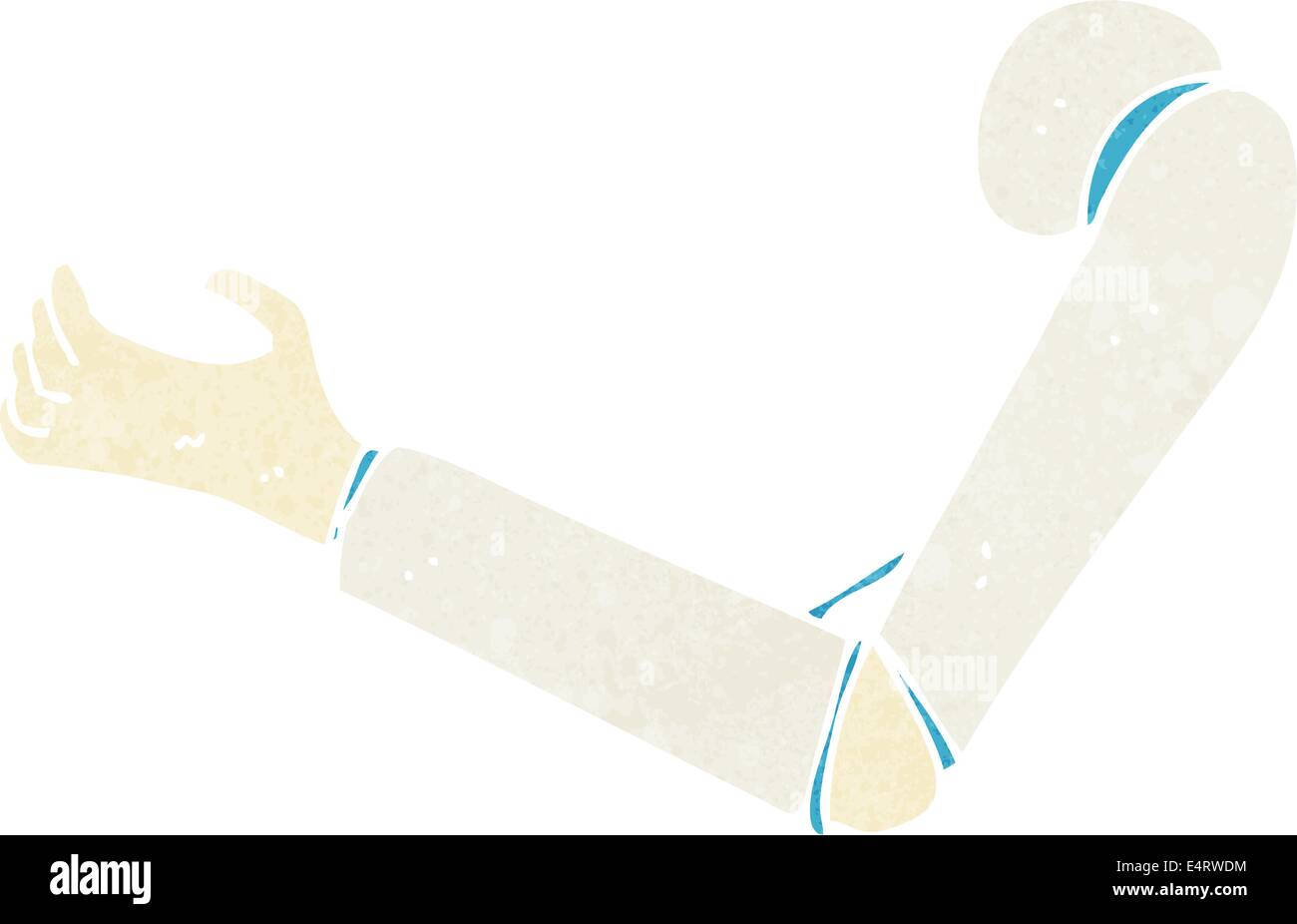 cartoon prosthetic arm Stock Vector Image & Art - Alamy