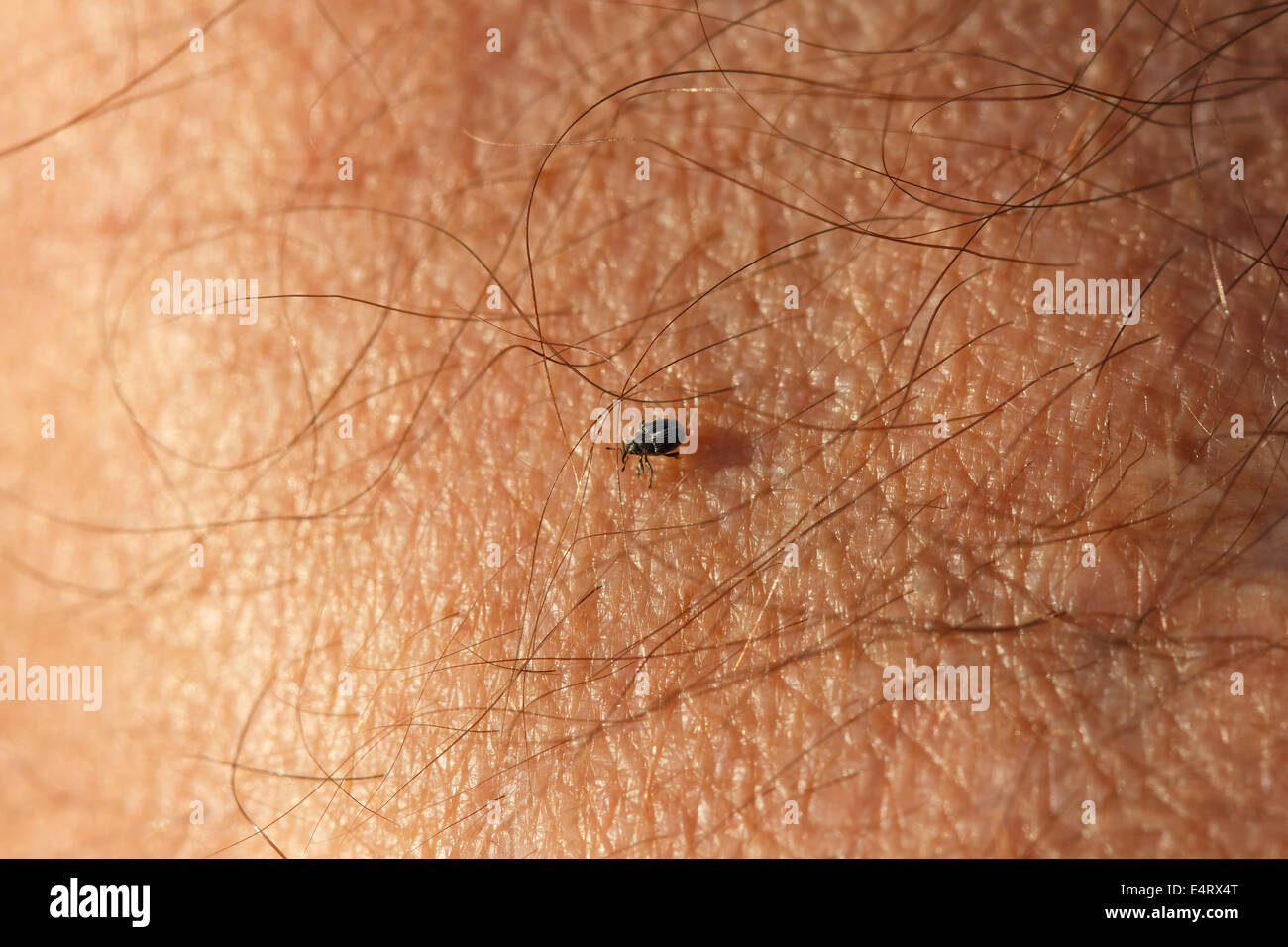 Beetle on human skin Stock Photo - Alamy