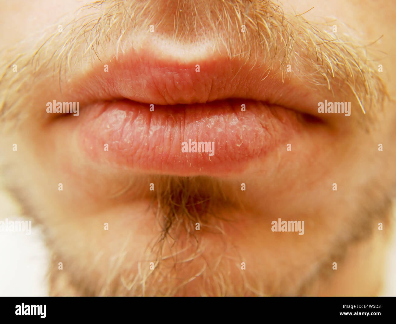 Dry male lips Stock Photo - Alamy