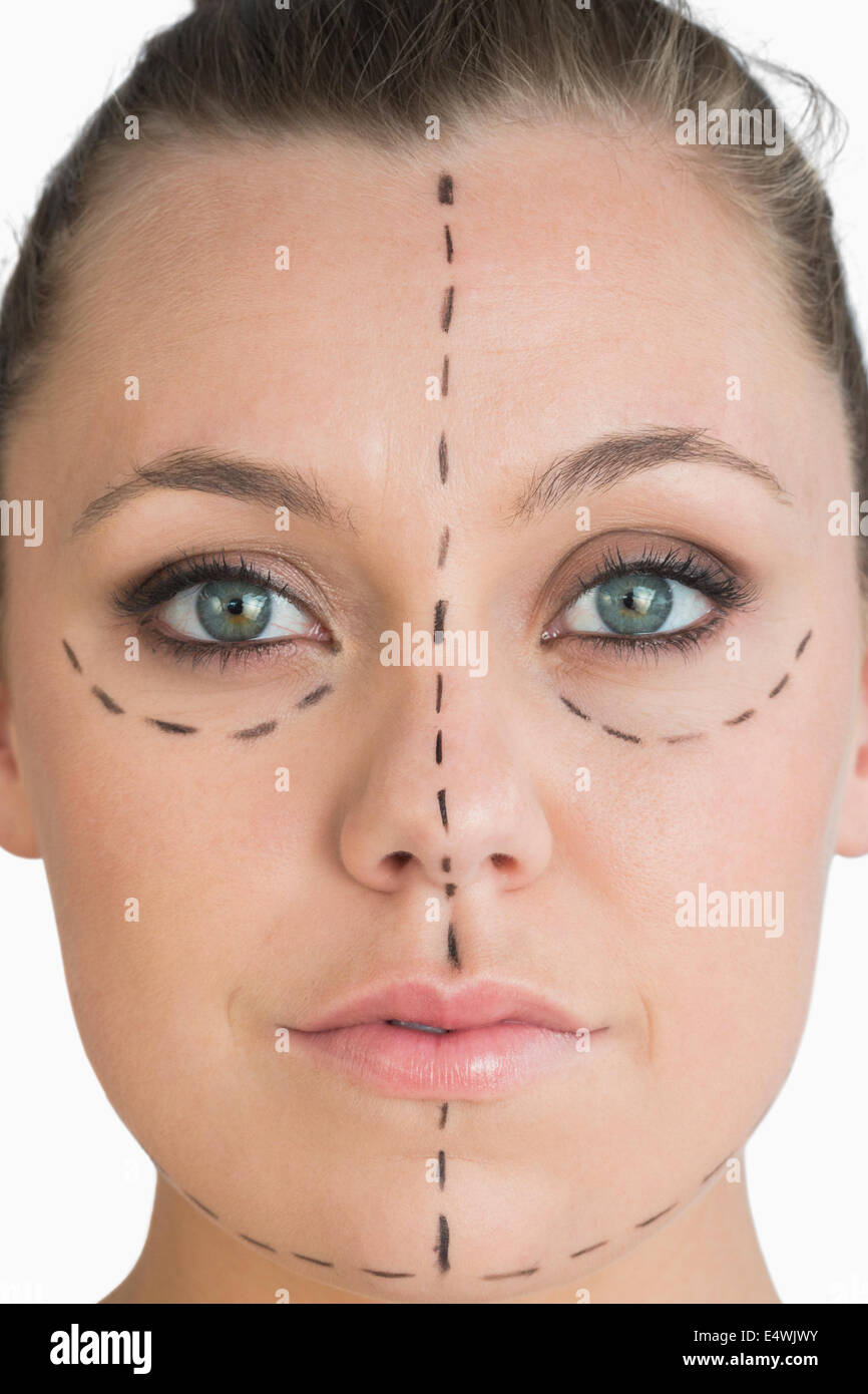 Woman ready to get face lift Stock Photo - Alamy