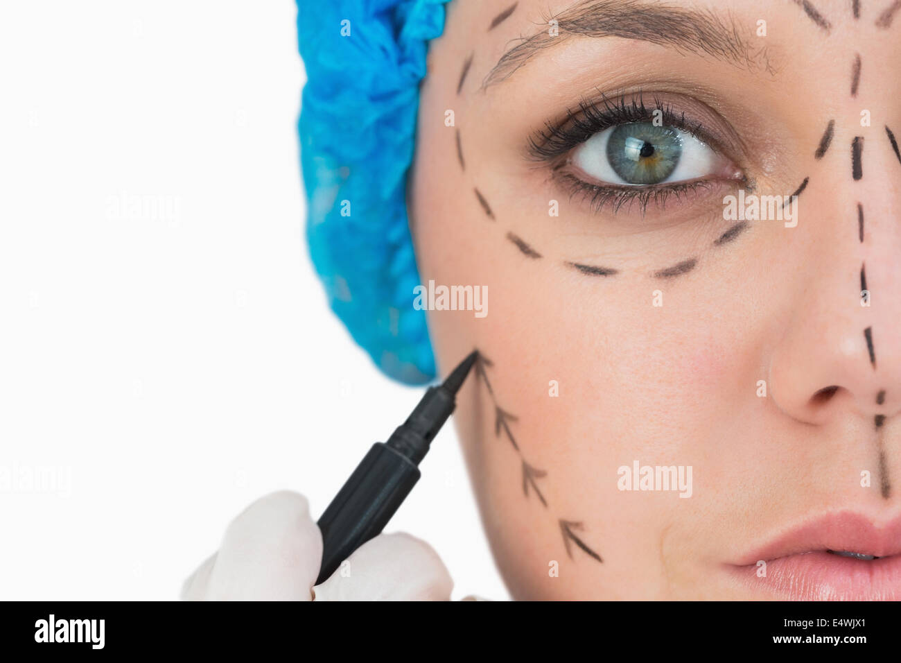 Surgical marking hi-res stock photography and images - Alamy