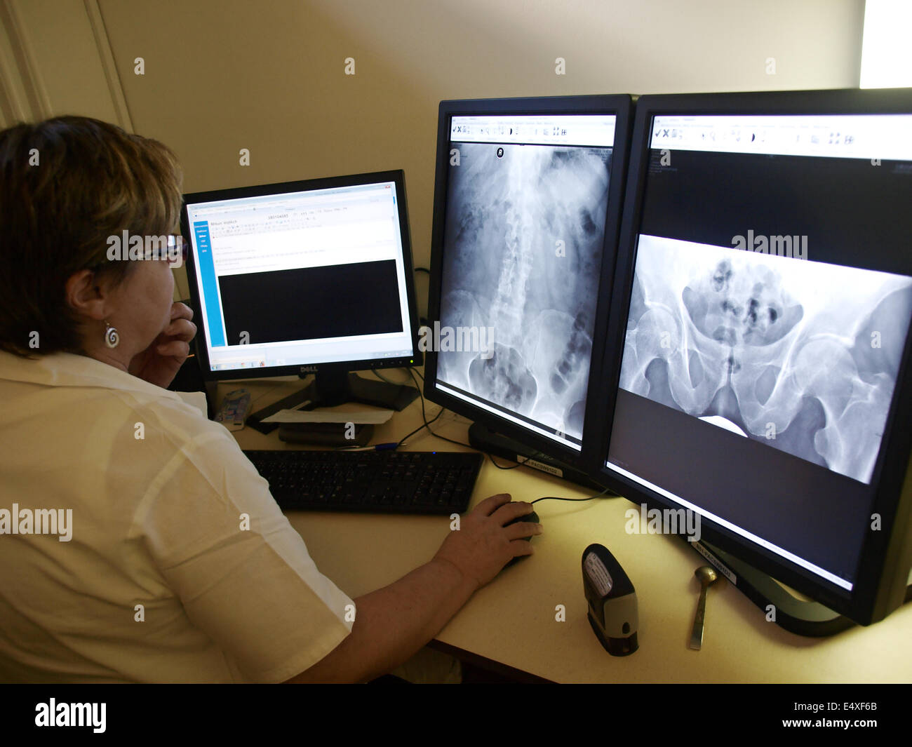 Diagnostic x ray hi-res stock photography and images - Alamy