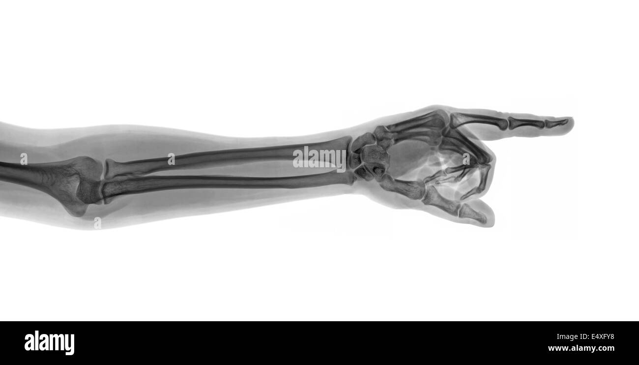 Skeleton hand pointing hi-res stock photography and images - Alamy Skeleton hand pointing hi-res stock photography and images - Alamy