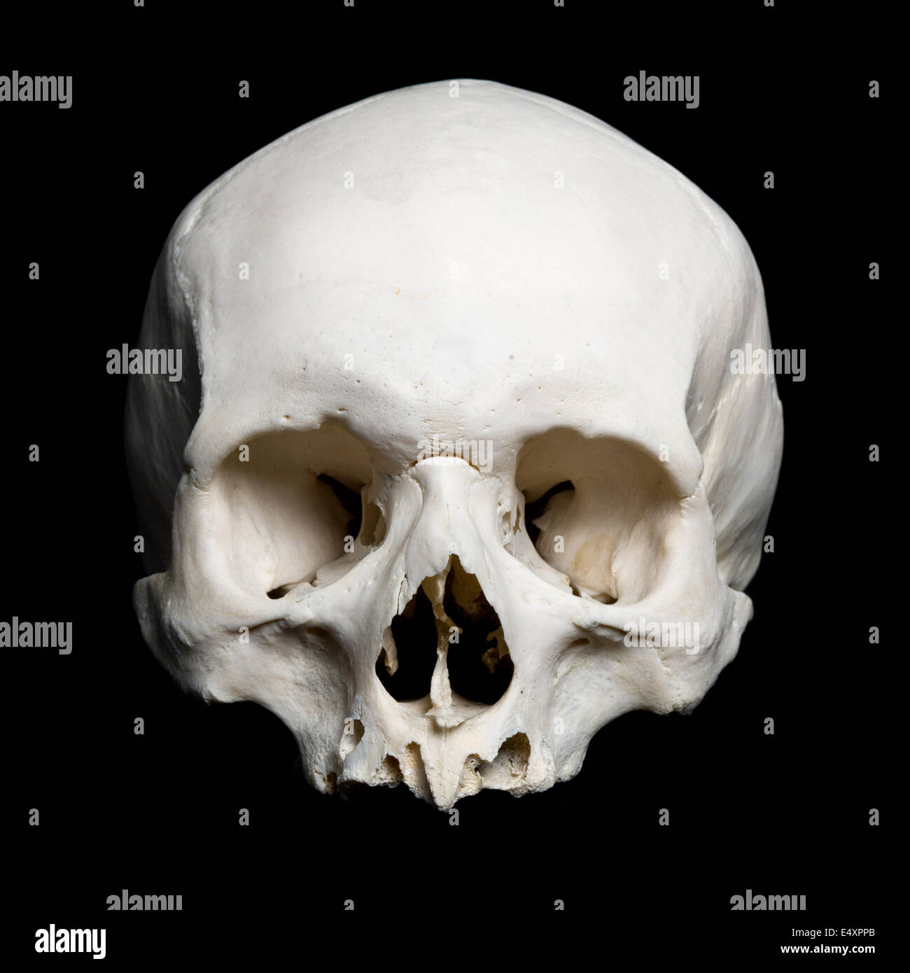Upper half of the real human Skull Stock Photo - Alamy