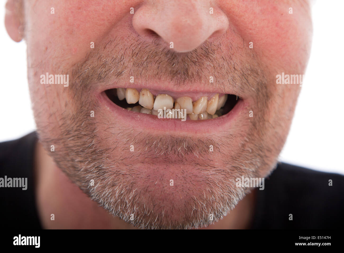 Displaying teeth hi-res stock photography and images - Alamy