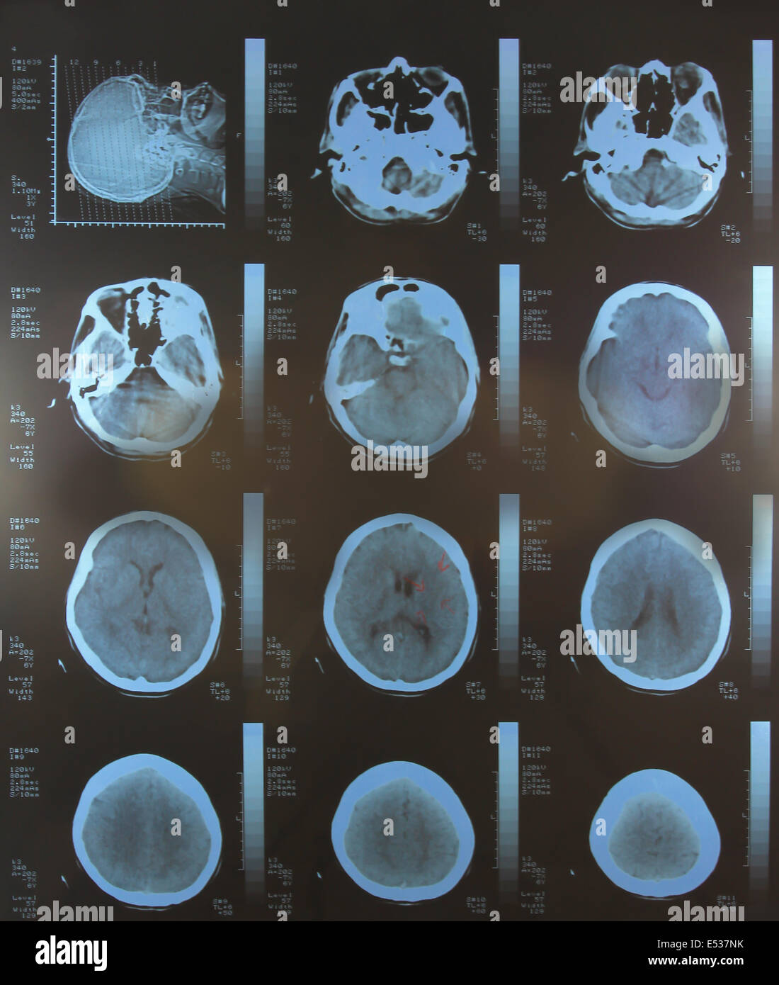 Photograph of the brain section hi-res stock photography and images - Alamy