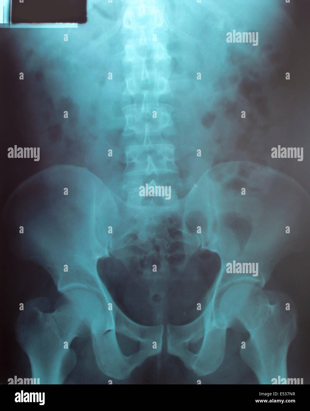 X-Ray Image Of Human for a medical diagnosis Stock Photo - Alamy